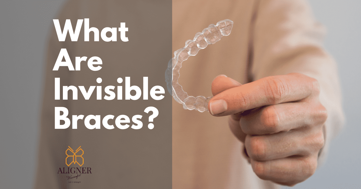 What Are Invisible Braces aka Clear/Transparent Aligners?